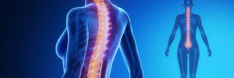 Postherpetic Neuralgia | NSPC Brain & Spine Surgery