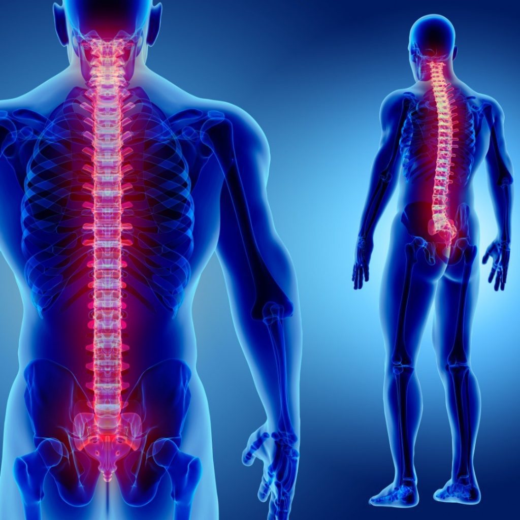 Mobi-C Cervical Disc Replacement | NSPC Brain & Spine Surgery